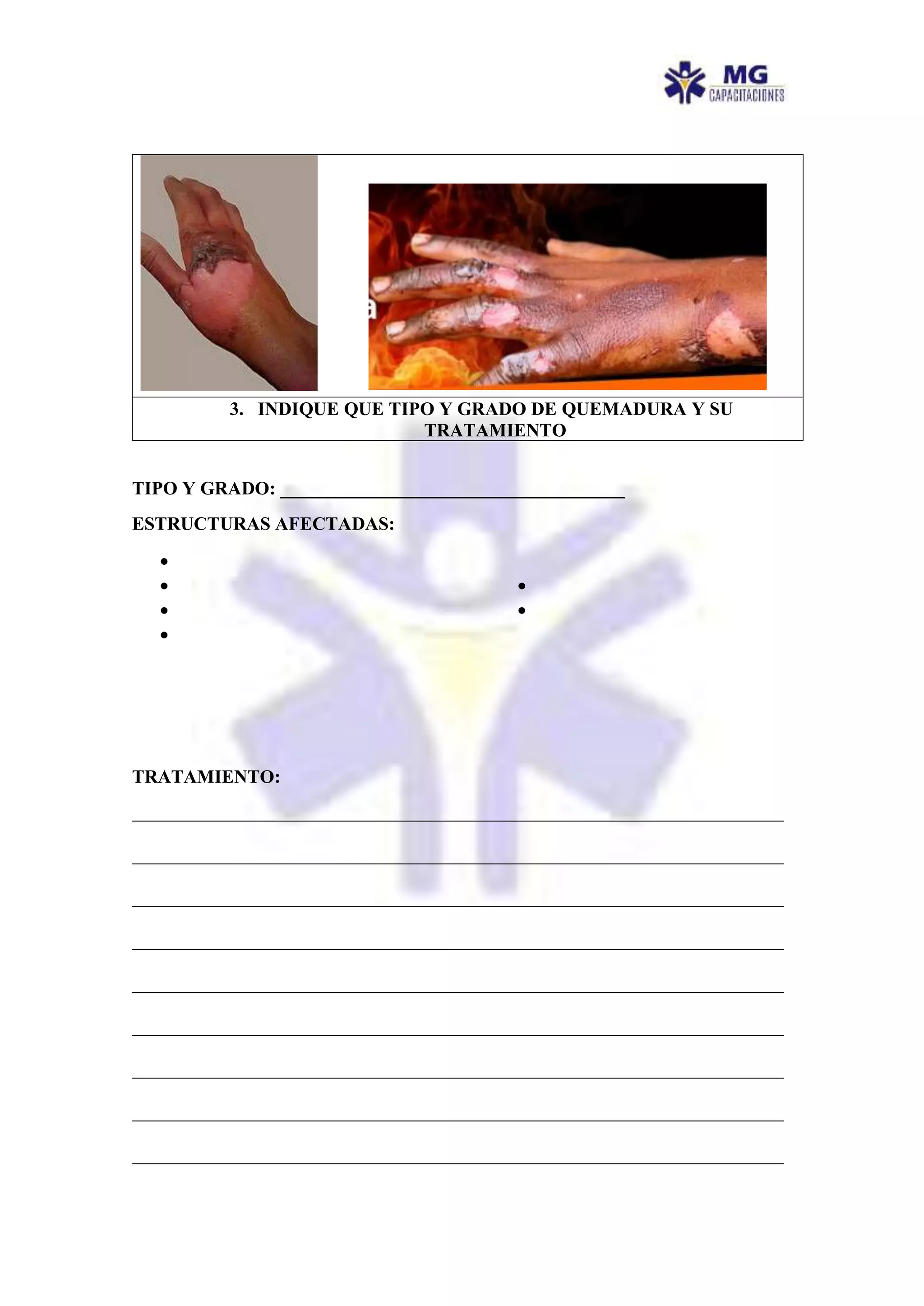 Taller grados de quemaduras y heridas y su tratamiento | PDF