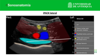 Taller Miembro inferior Sono Anatomia.pptx