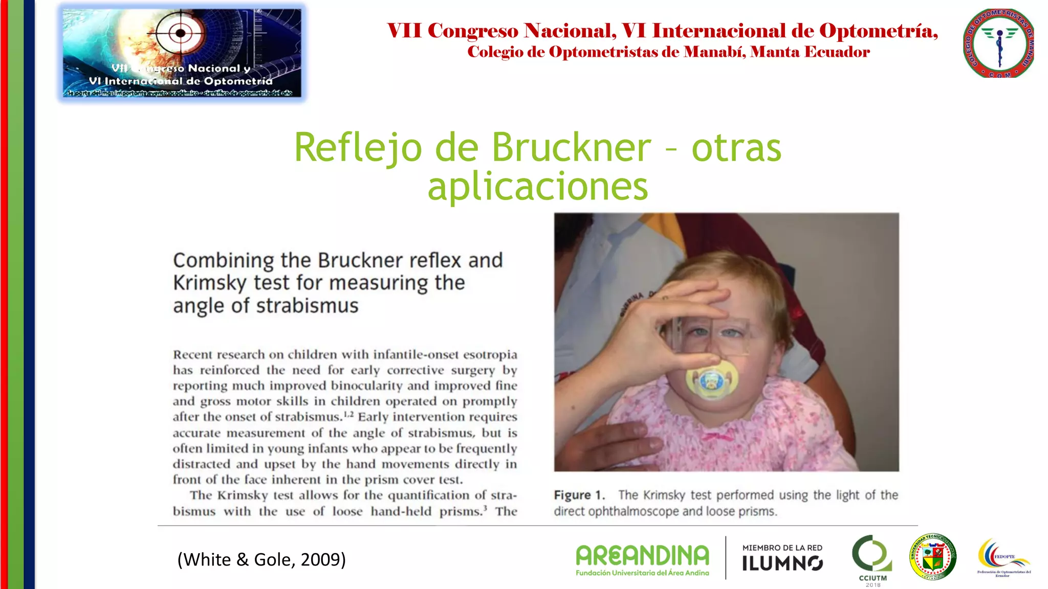 Taller reflejo de bruckner | PDF