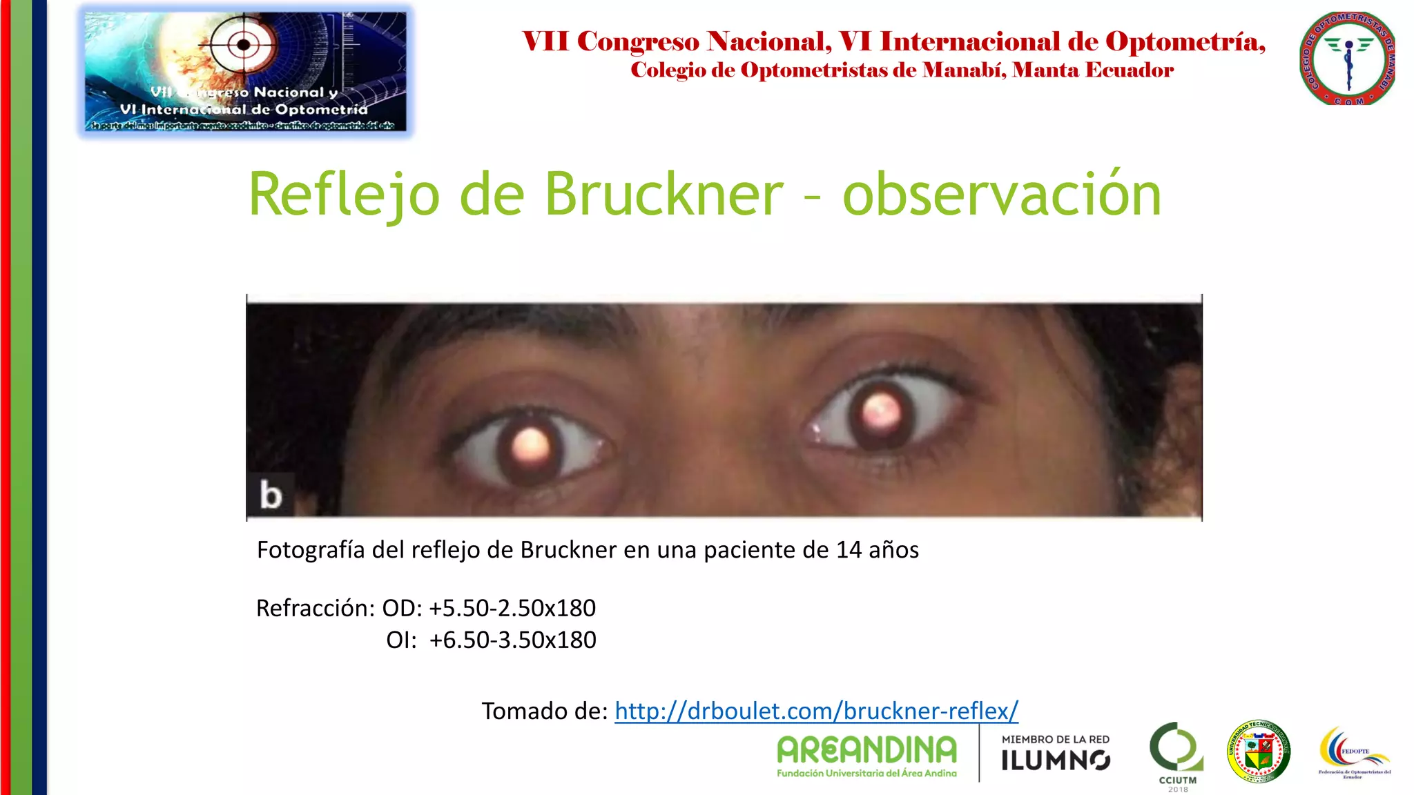 Taller reflejo de bruckner | PPT