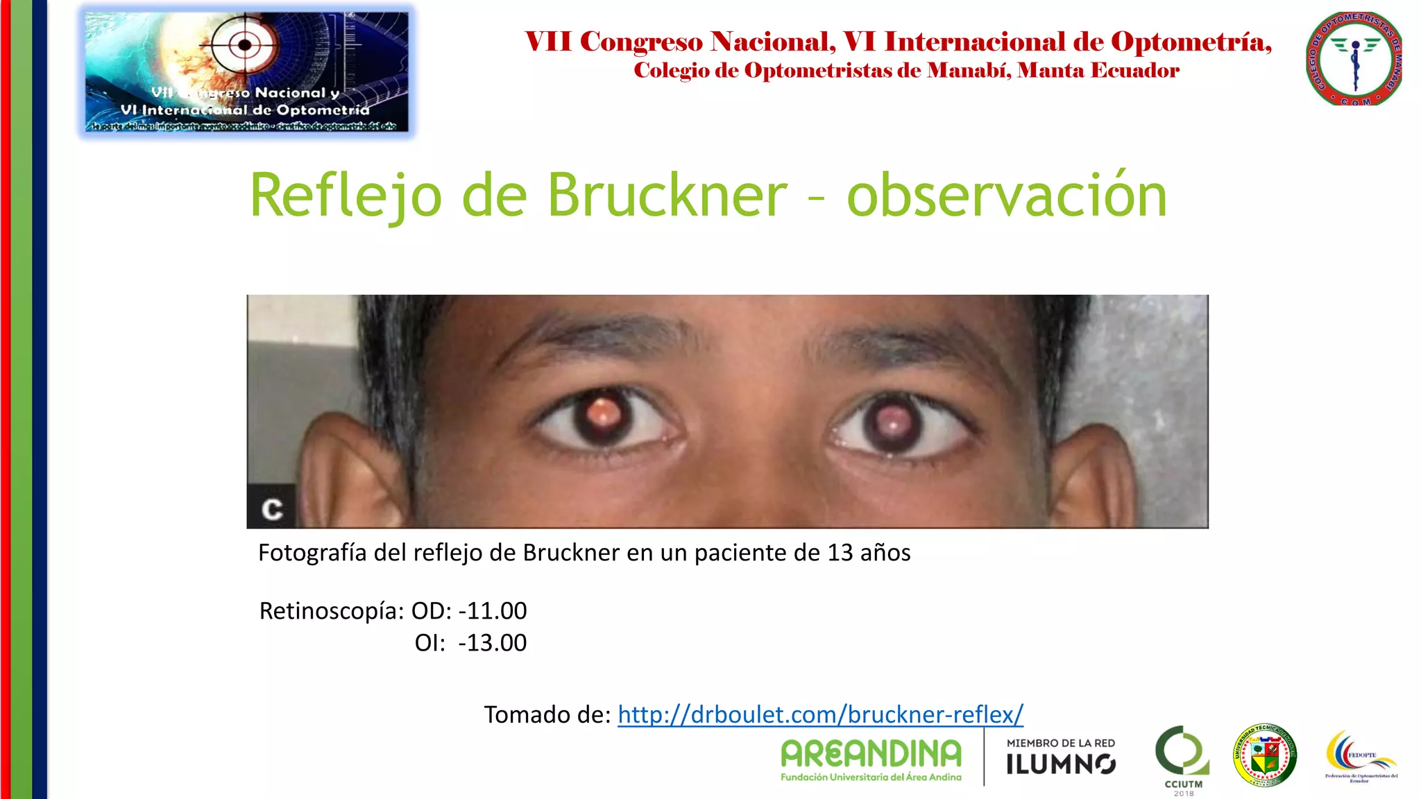Taller reflejo de bruckner | PDF