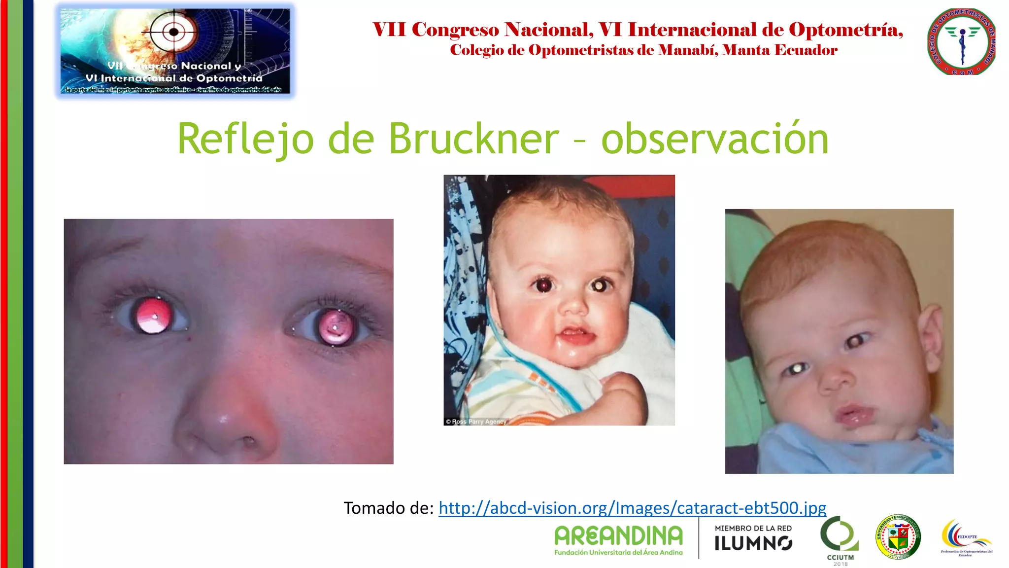 Taller reflejo de bruckner | PDF