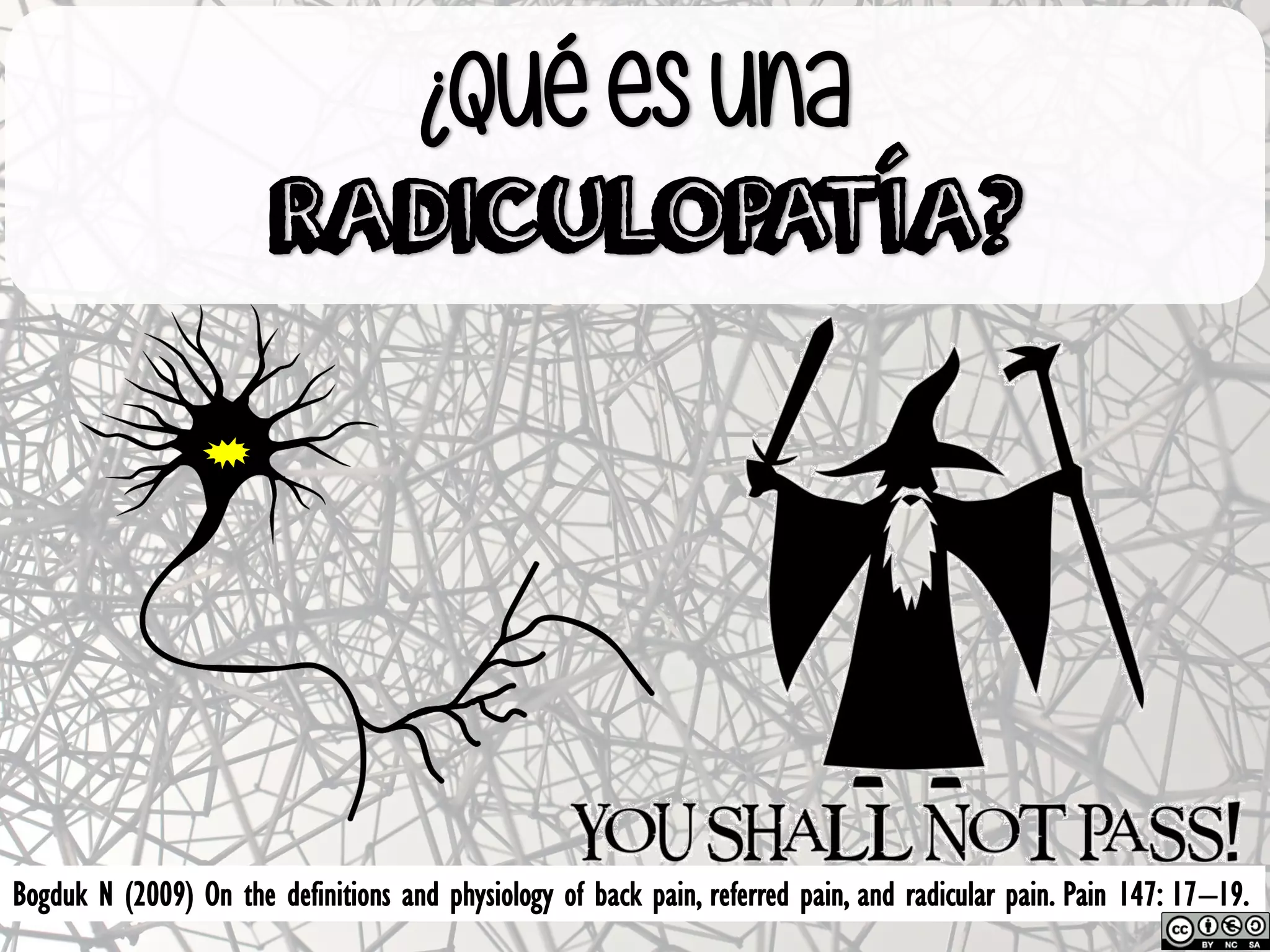 Radiculopatía vs dolor radicular | PDF