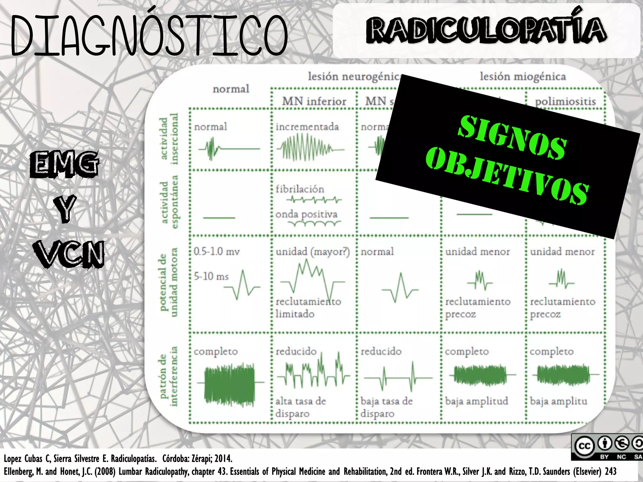 Radiculopatía vs dolor radicular | PDF