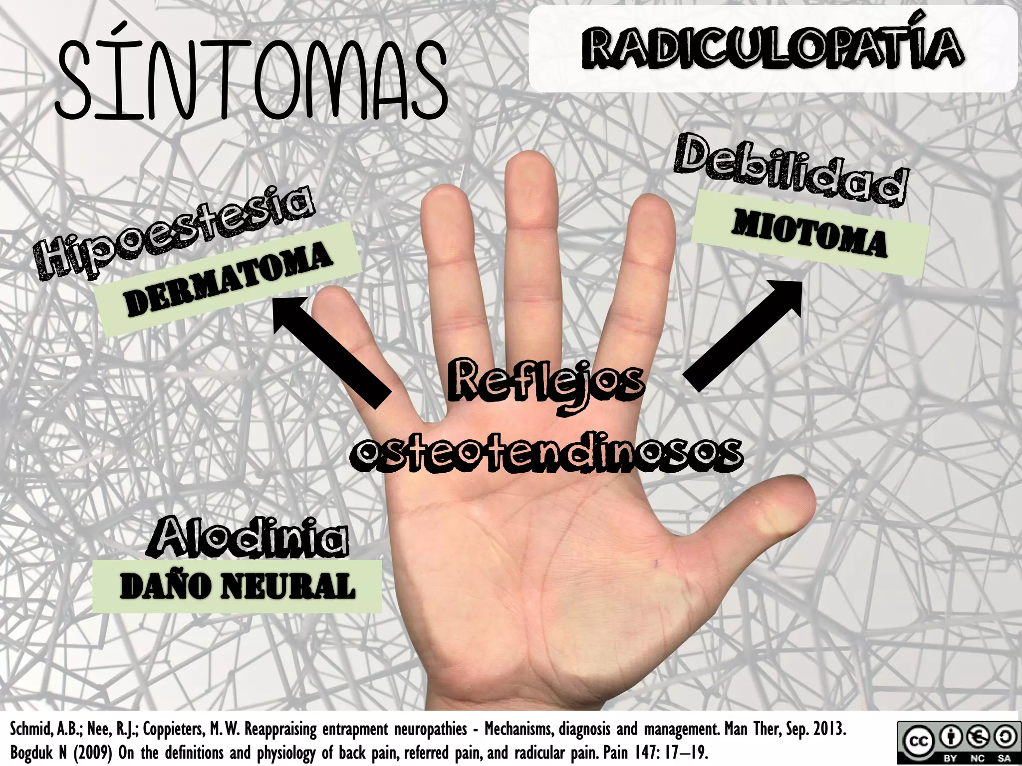 Radiculopatía vs dolor radicular | PDF