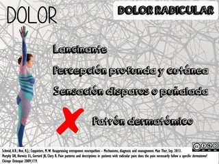 Radiculopatía vs dolor radicular | PDF