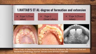 treatment of talon cusp in children | PPTX