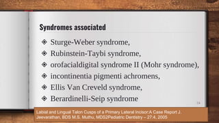 treatment of talon cusp in children | PPTX