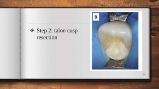 treatment of talon cusp in children | PPTX