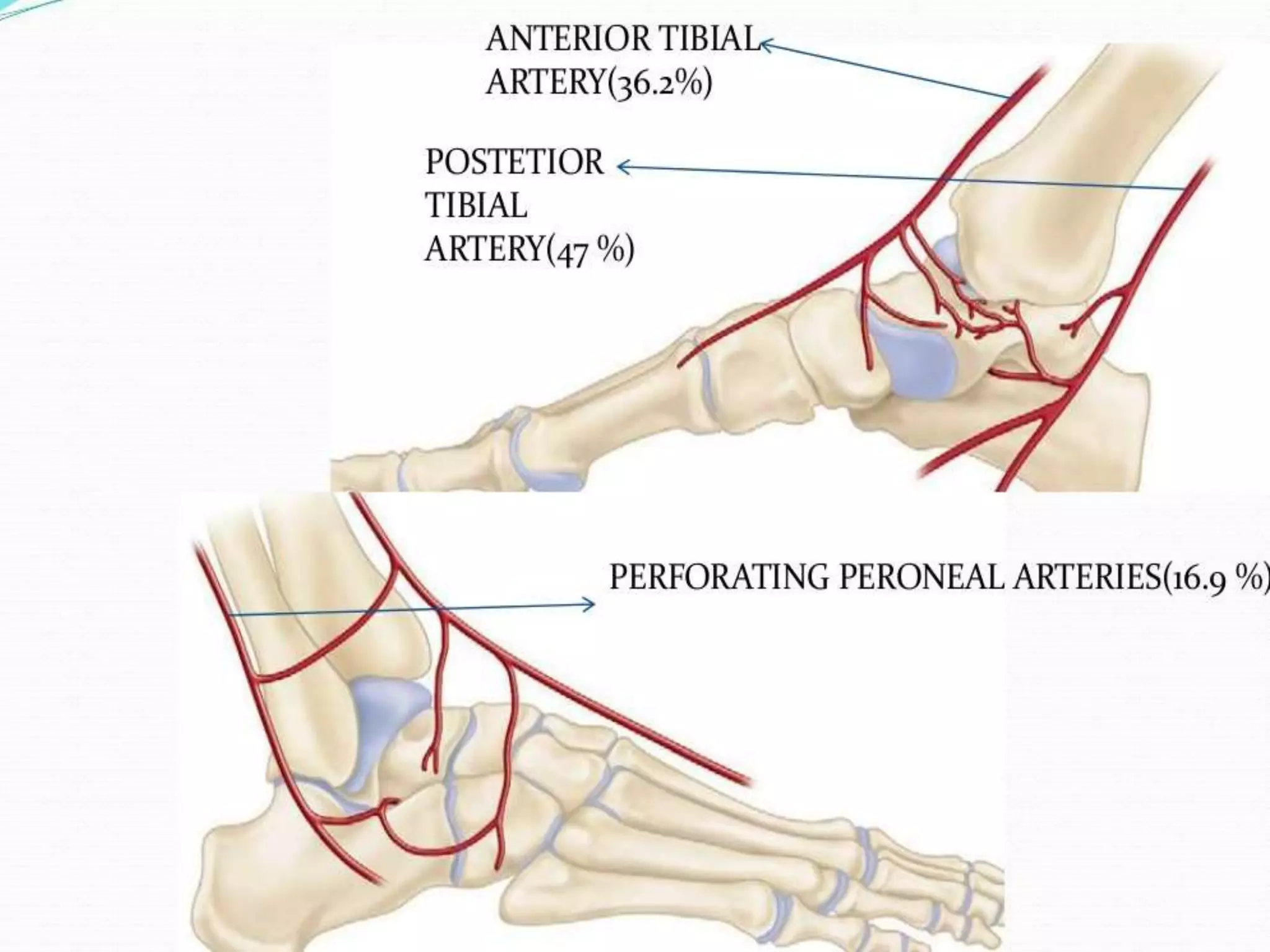 Talus body fracture management | PPT