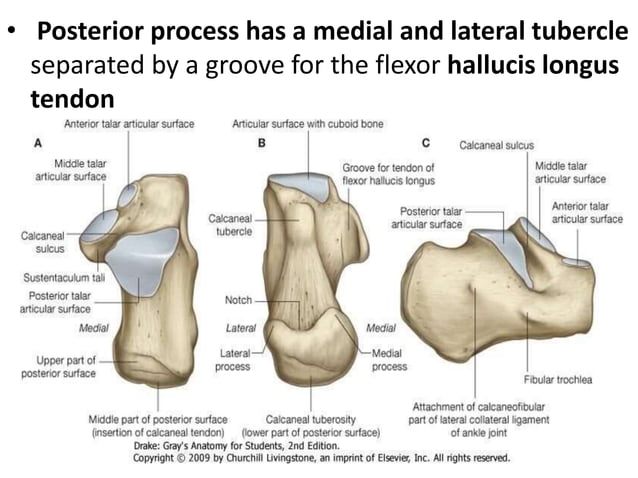 Talus body fracture management | PPT