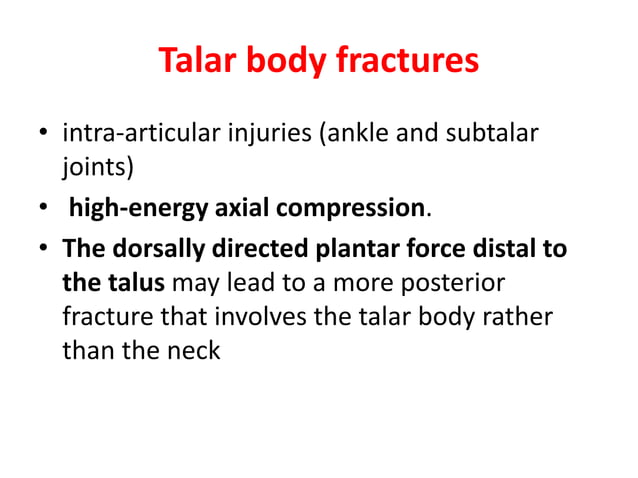 Talus body fracture management | PPT