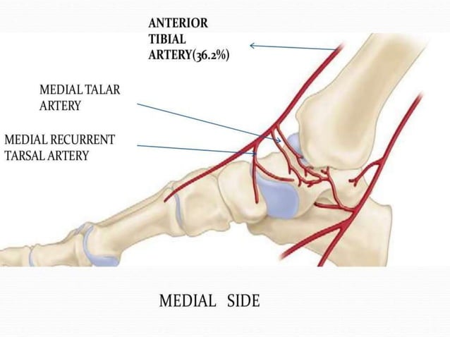 Talus body fracture management | PPT