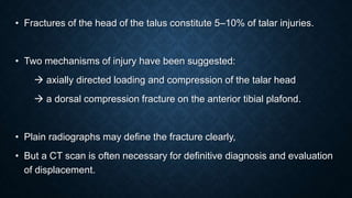 Talus neck fracture of Ankle in leg injuries.pptx