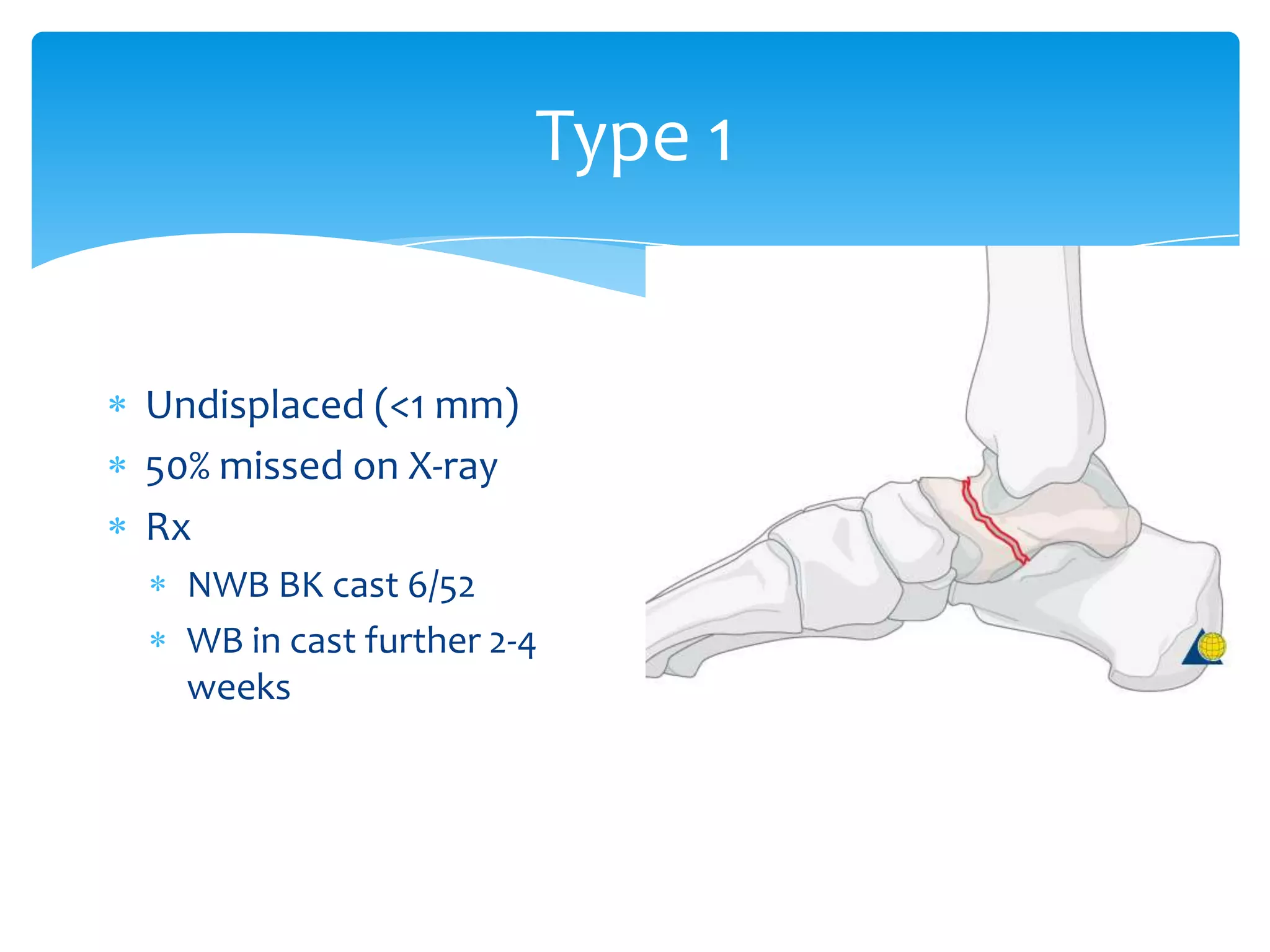 Talus anatomy, blood supply & fractures | PPTX