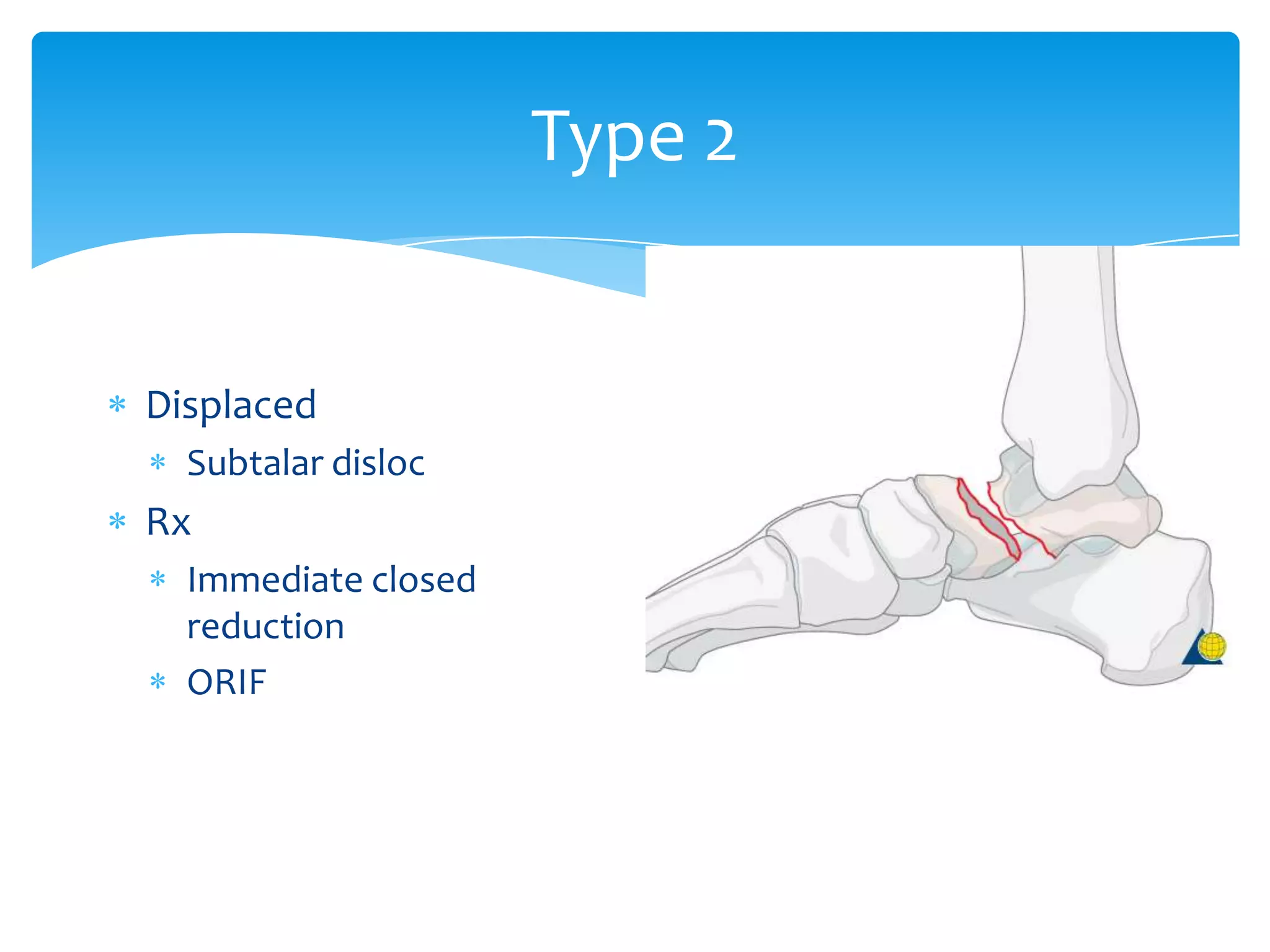 Talus anatomy, blood supply & fractures | PPTX | Death, Injury, or ...