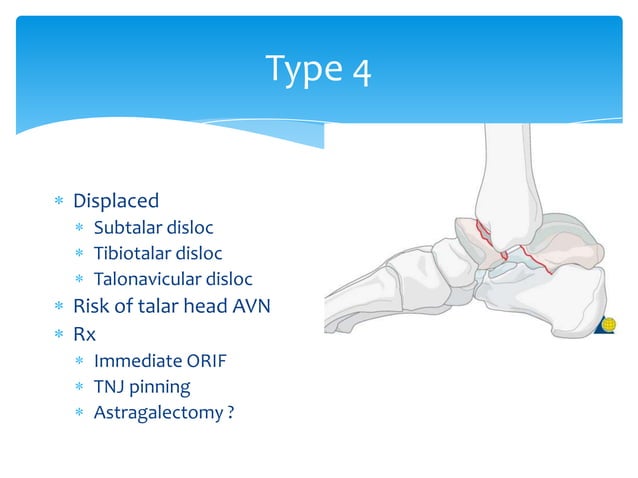 Talus anatomy, blood supply & fractures | PPT