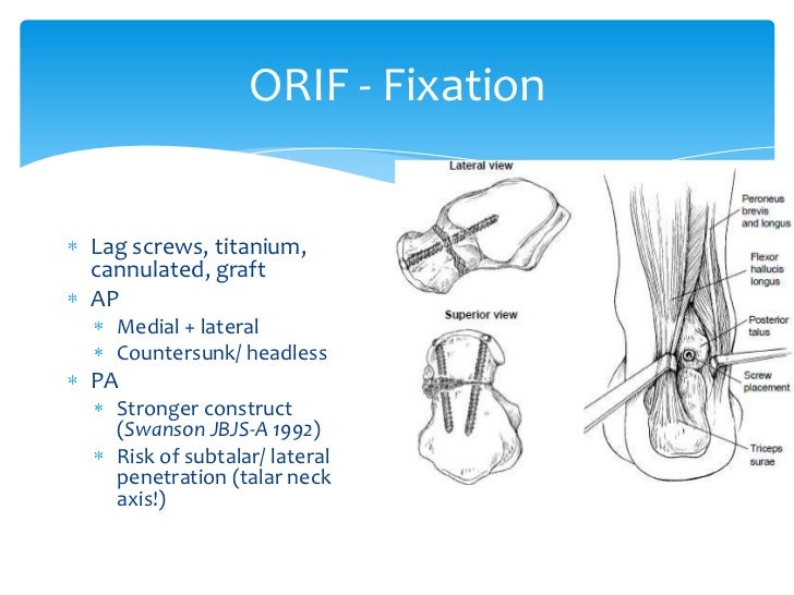 Talus anatomy, blood supply & fractures