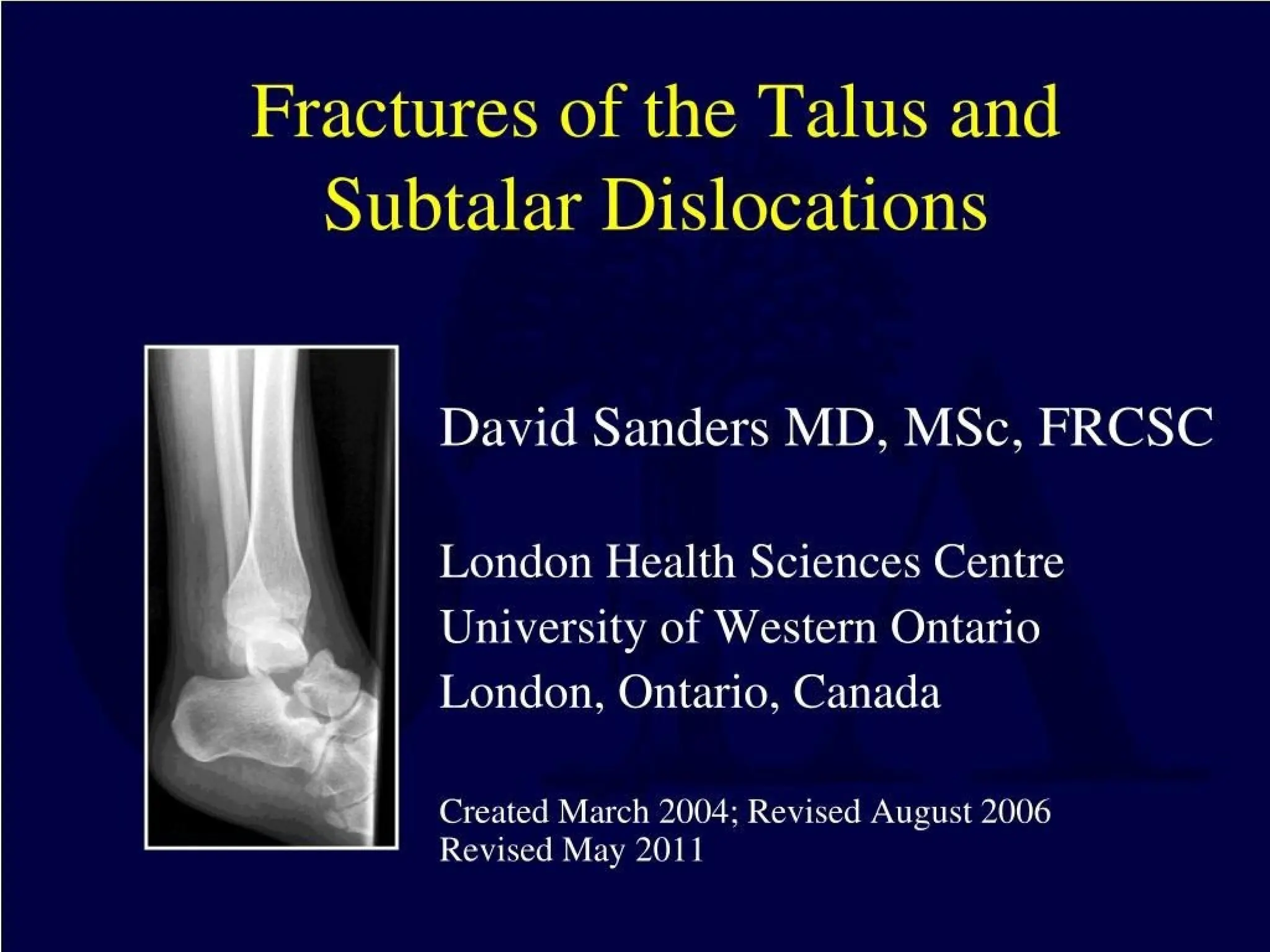 Talus+Fractures and subtalar dislocations.pptx