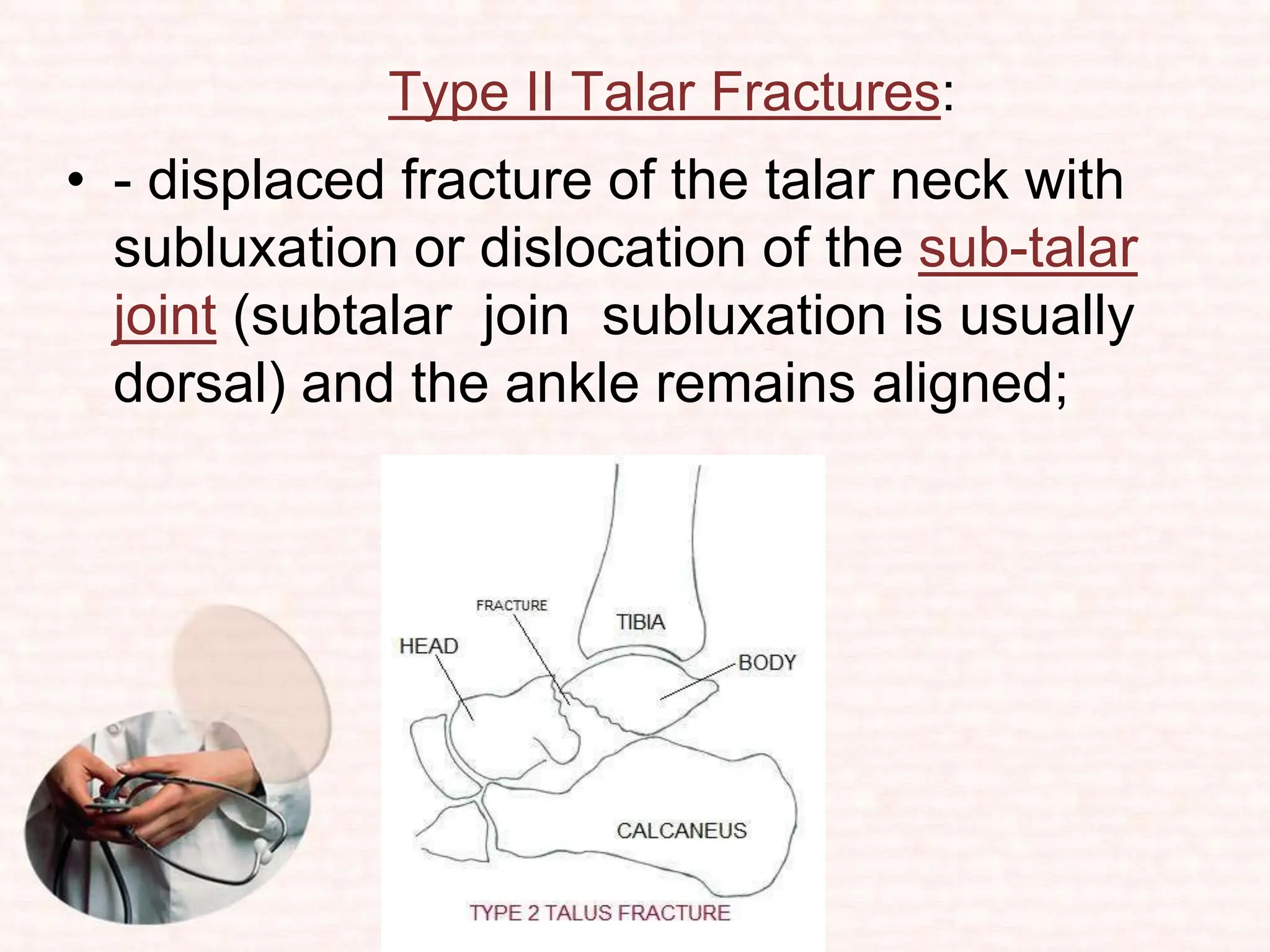 TALUS FRACTURES Classified clinical features and management | PPT