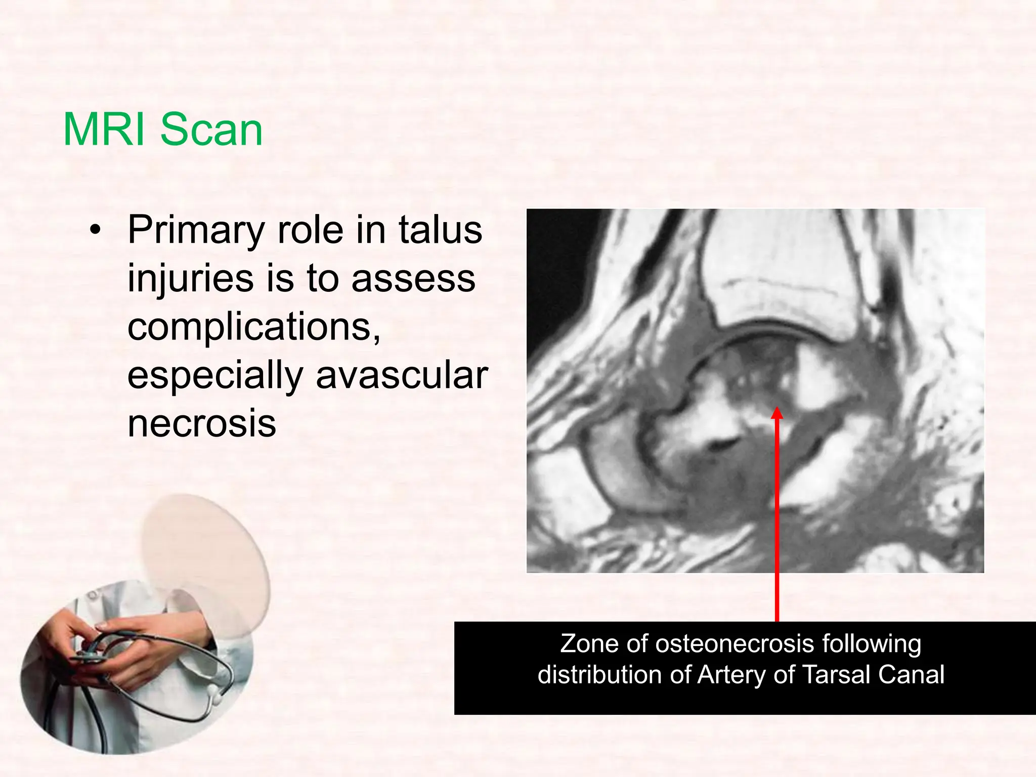 TALUS FRACTURES Classified clinical features and management | PPT