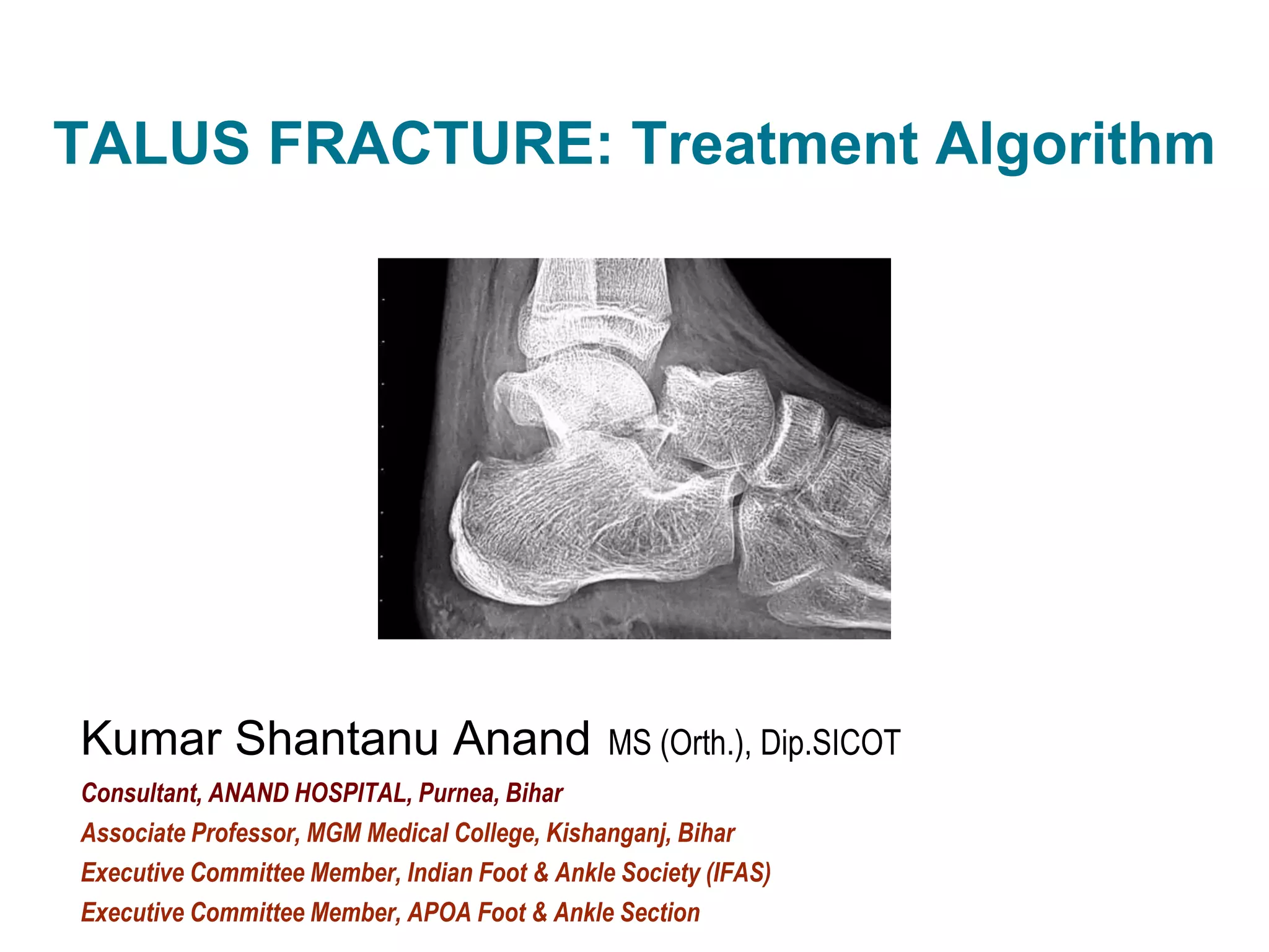 Talus fracture treatment algorithm | PPTX | Death, Injury, or Military ...
