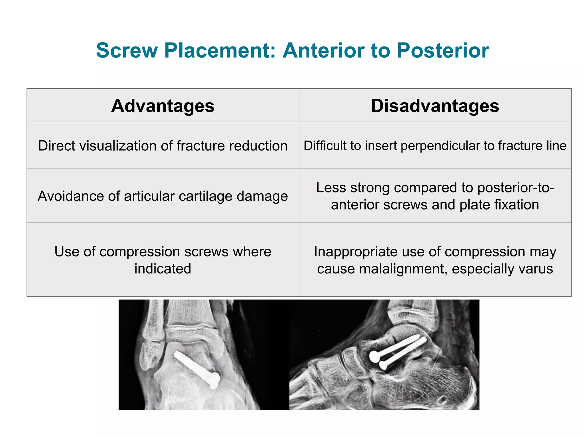 Talus fracture treatment algorithm | PPTX | Death, Injury, or Military ...