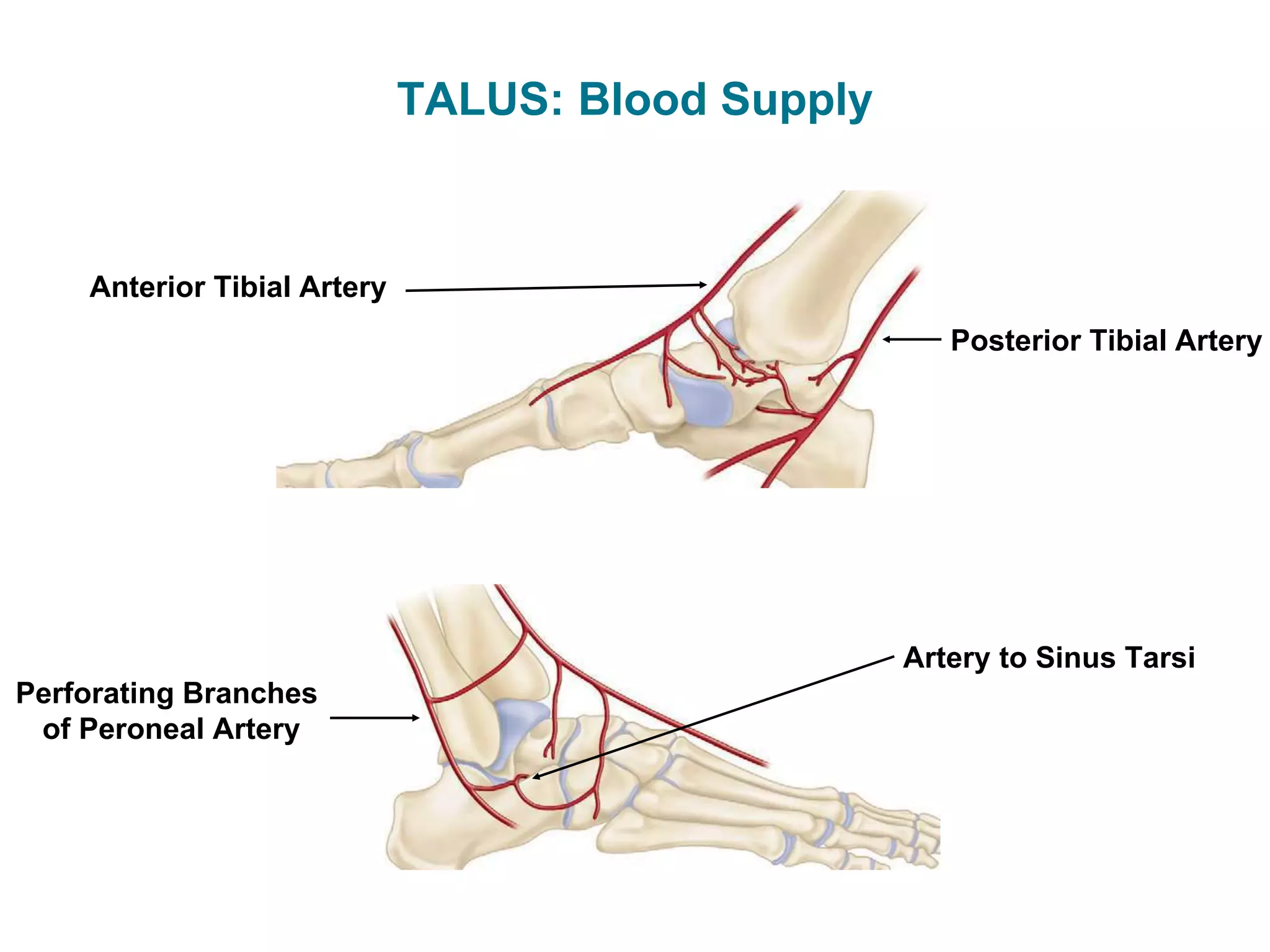 Talus fracture treatment algorithm | PPTX | Death, Injury, or Military ...