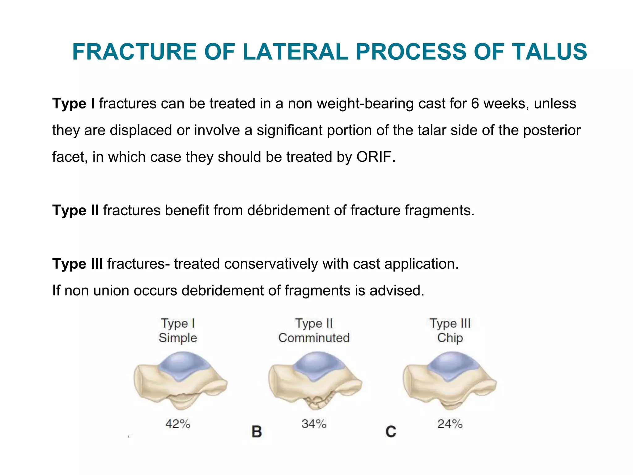 Talus fracture treatment algorithm | PPTX | Death, Injury, or Military ...