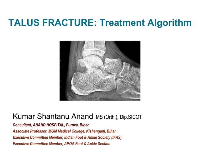 Talus fracture treatment algorithm | PPT