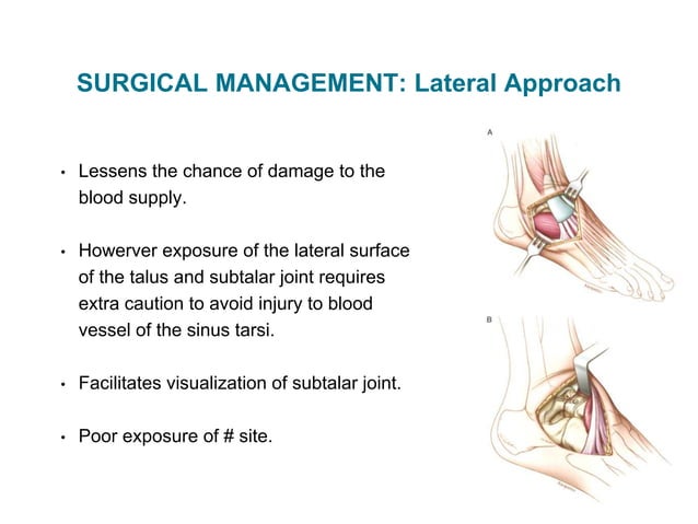 Talus fracture treatment algorithm | PPT