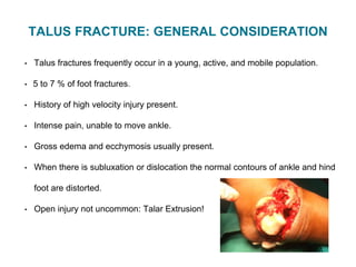 Talus fracture treatment algorithm | PPTX | Death, Injury, or Military ...