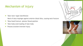 TALUS fracture principles and management.ppt