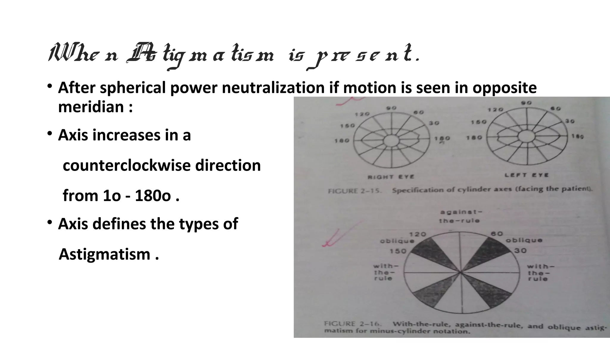 Static retinoscope presentation by Tamalika | PPS