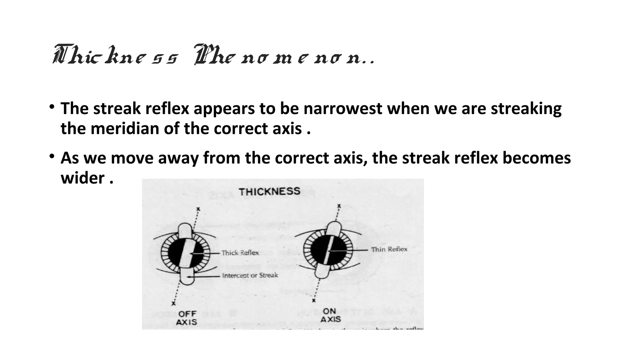 Static retinoscope presentation by Tamalika | PPS