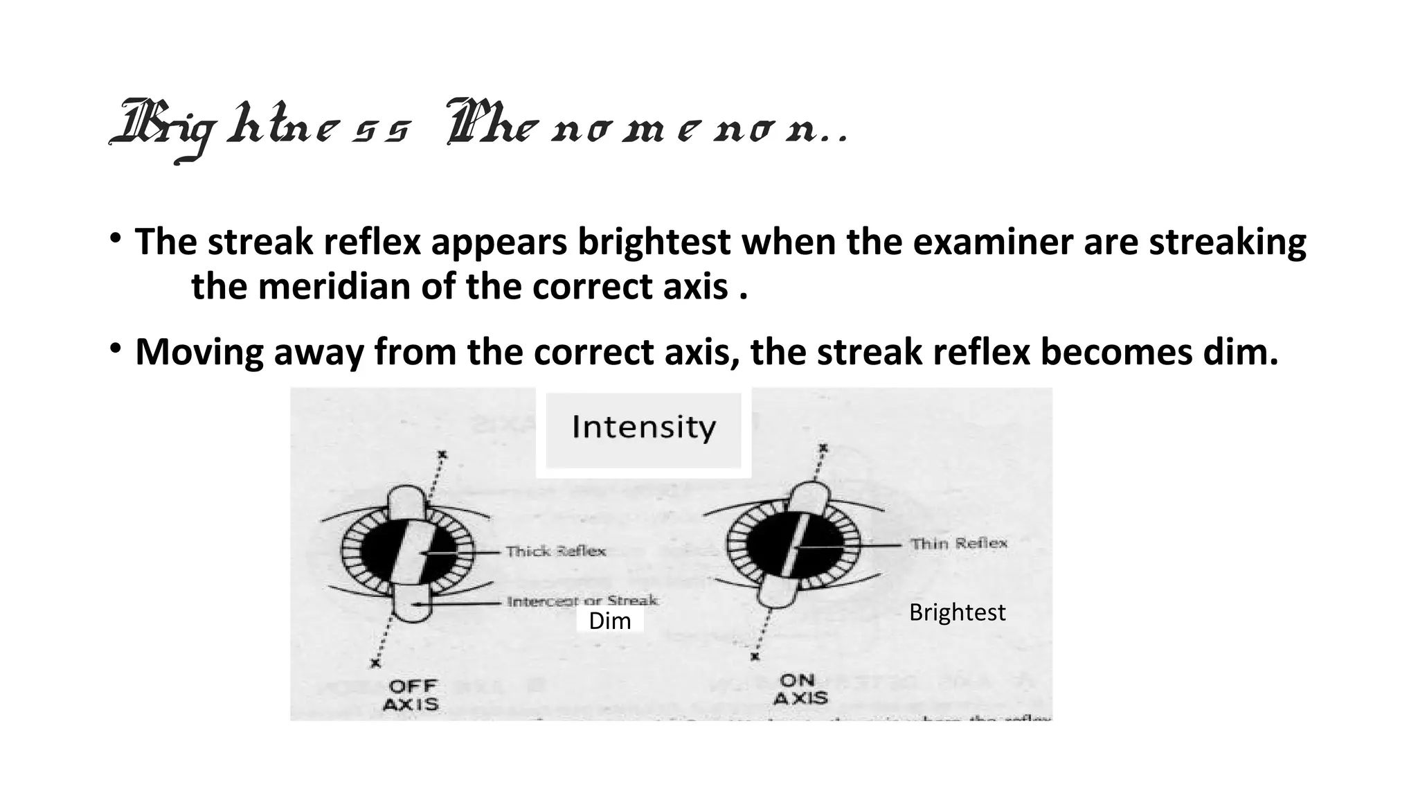 Static retinoscope presentation by Tamalika | PPS