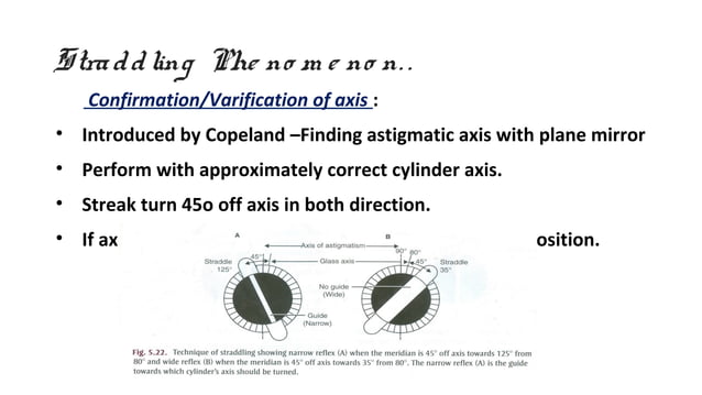 Static retinoscope presentation by Tamalika | PPS | Eye and Vision ...