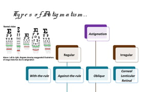 Static retinoscope presentation by Tamalika | PPS