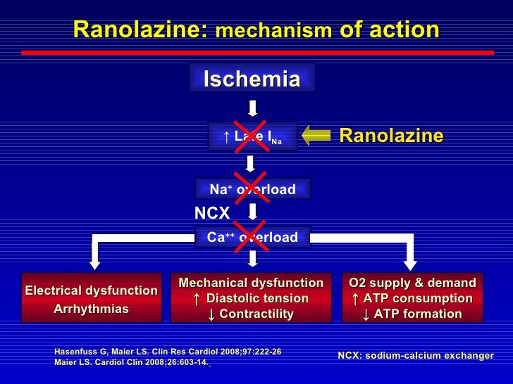 Nuevas perspectivas en el tratamiento de la angina crónica estable