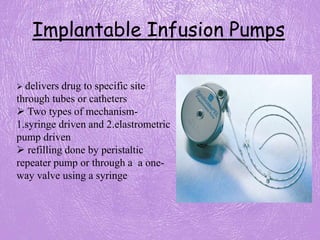 Implantable polymer based drug delivery system for tailored drug ...