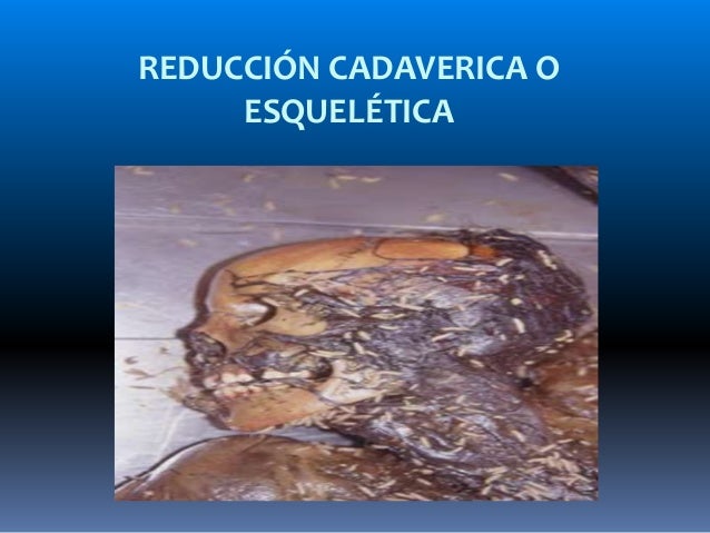 Tanatocronodiagnostico