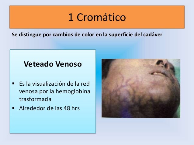 Tanatología forense equipo 1