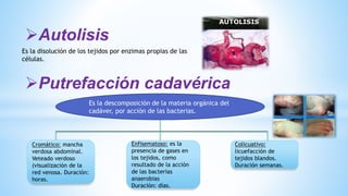 Tanatologia forense | PPT