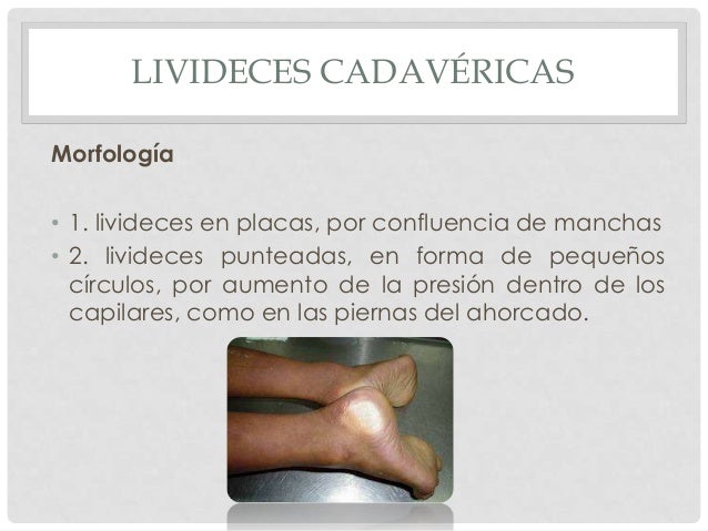 fenomenos cadavericos