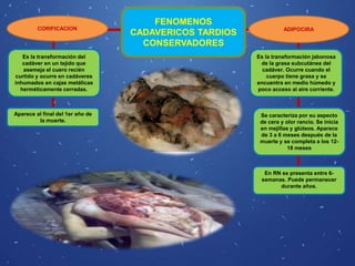 GLADYS BARAZARTE TERAN.- Tanatologia Levantamiento Cadaver | PPTX