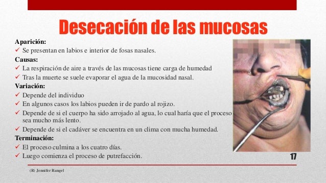 Tanatologia presentacion