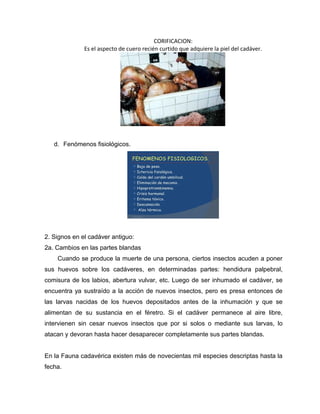 Tanatologia, tanatocronodiagnostico y autopsia | DOC