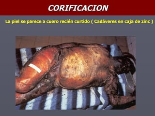 Tanatosemiologia | PPS