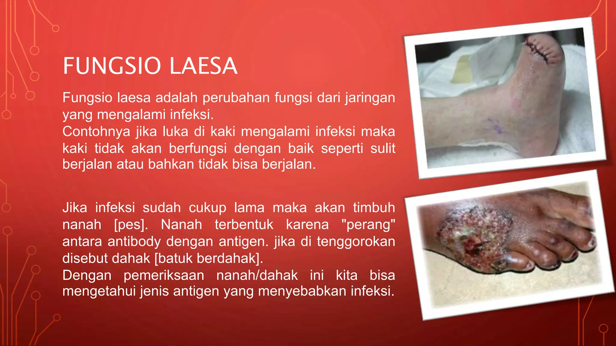 Tanda tanda infeksi | PPTX