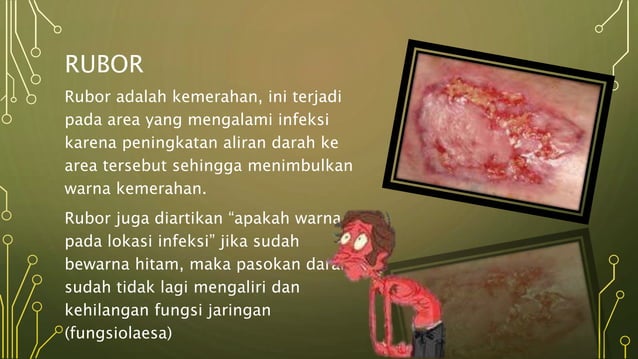 Tanda tanda infeksi | PPT